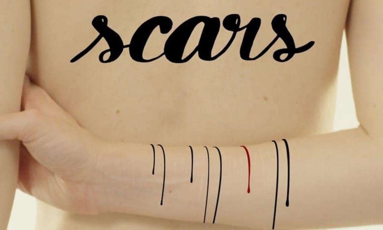 Scars - Where to Watch and Stream Online – Entertainment.ie